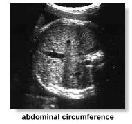 Overview: Obstetric Ultrasound Scans | Faculty of Medicine