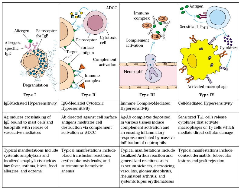 Hypersensitivity Reactions Type I IV Faculty Of Medicine