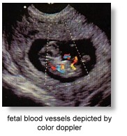 Overview: Obstetric Ultrasound Scans | Faculty of Medicine