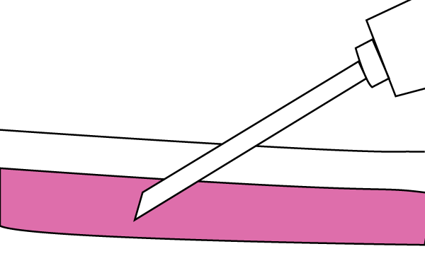 How To Draw Blood Like A Pro: Step-By-Step Guide | Faculty of Medicine
