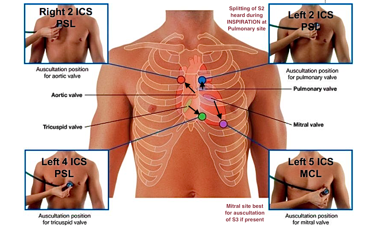 Heart Auscultation Faculty Of Medicine