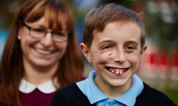 Different, Not Emotionless: The Ugly Psychological Truth About Facial ...