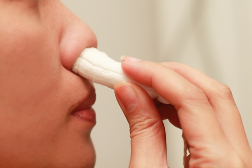 First Aid For Nosebleeds | Faculty of Medicine