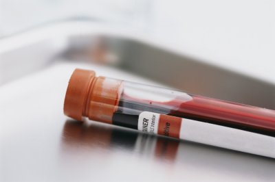 ANC Blood Test Results Explained | Faculty of Medicine