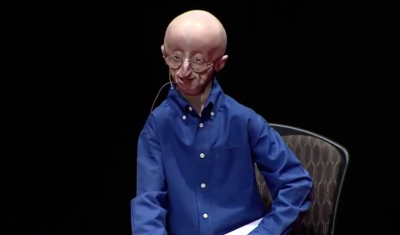 Right Before Dying From Progeria , Sam Revealed His Three Secrets To ...