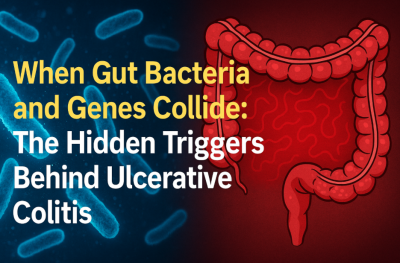 Why Some People Get Ulcerative Colitis — and Others Don’t | Faculty of ...